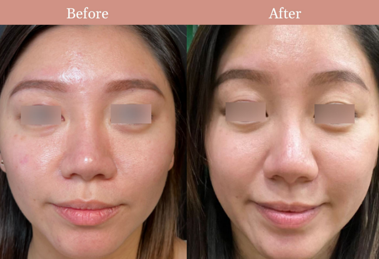 AuraLux Aesthetic Laser | Total skin health solutions